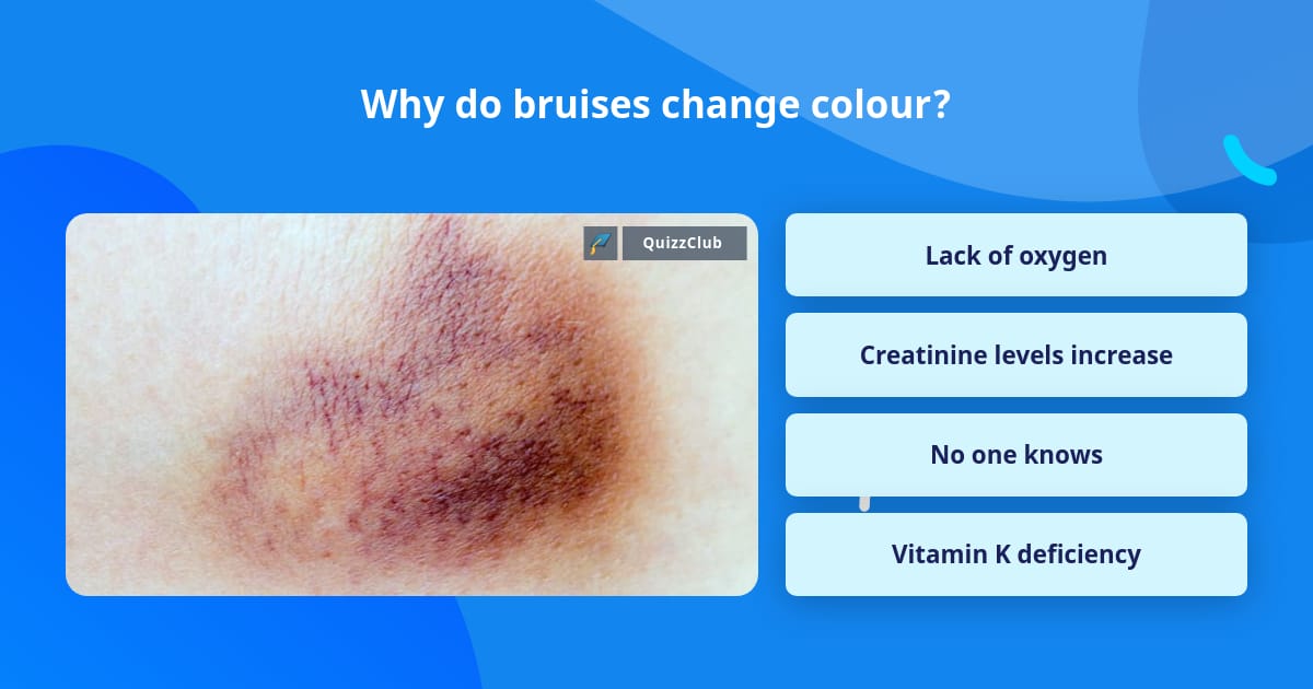 Why do bruises change colour? | Trivia Answers | QuizzClub