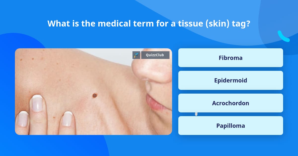 What Is The Medical Term For A Trivia Questions QuizzClub what-is-the-medical-term-for-a-trivia-questions-quizzclub